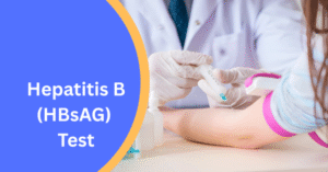 Hepatitis B Testing (HBsAg): Early Detection & Diagnosis Guide